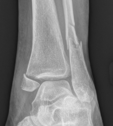 Background | The Bone School